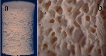 Ceramic Hydroxyapatite